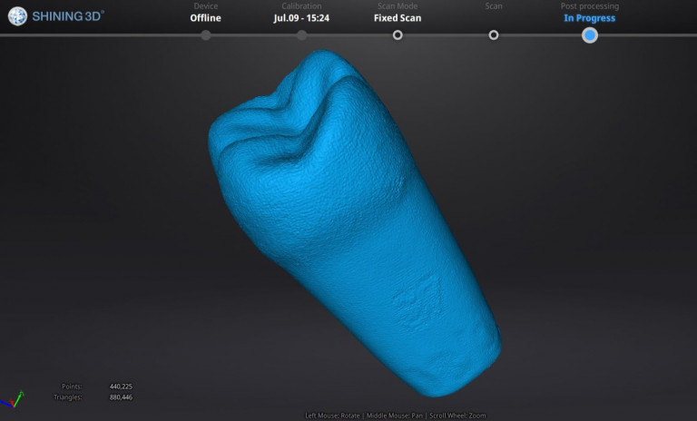 3D Printed Teeth | 3D Printing Service In Australia